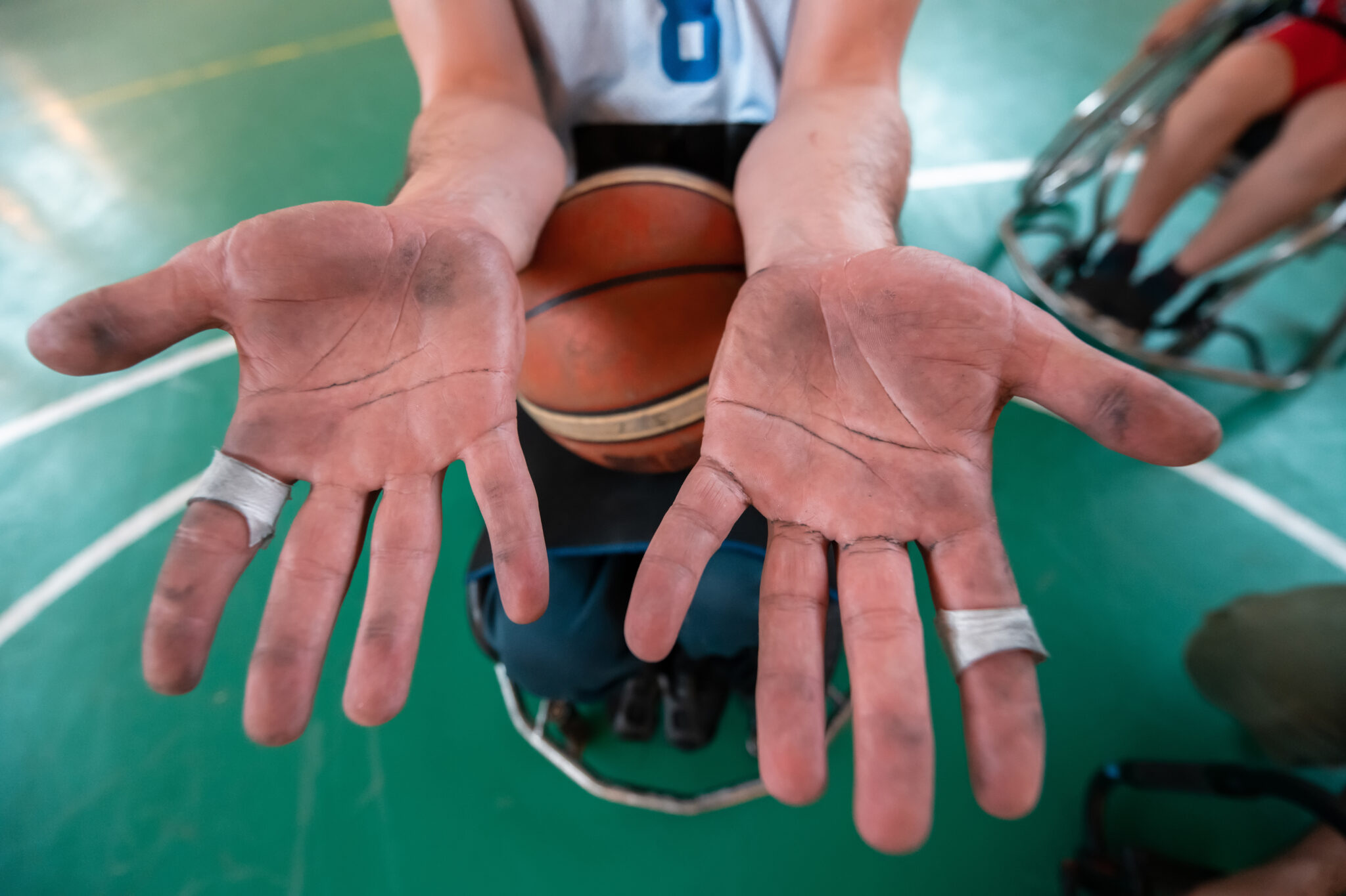 Preventing and Treating Common Basketball Injuries